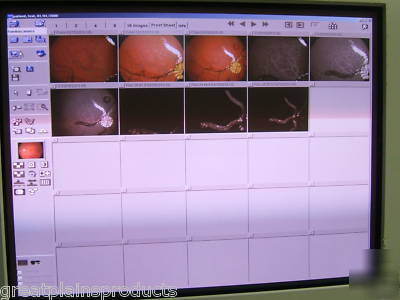 Zeiss ff 450PLUS ir fundus camera visupac FF450 plus ir